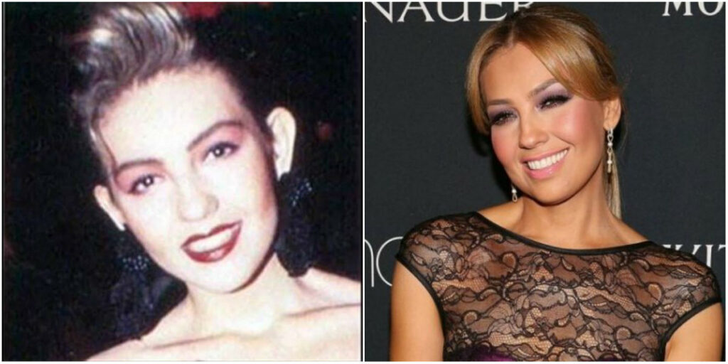 Thalía antes y después de cirugías. ¿Cuántas se ha hecho?